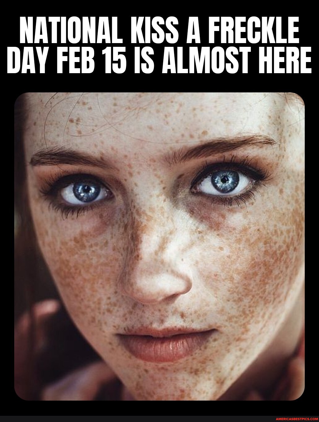 NATIONAL KISS A FRECKLE DAY FEB 15 IS ALMOST HERE - America’s best pics ...