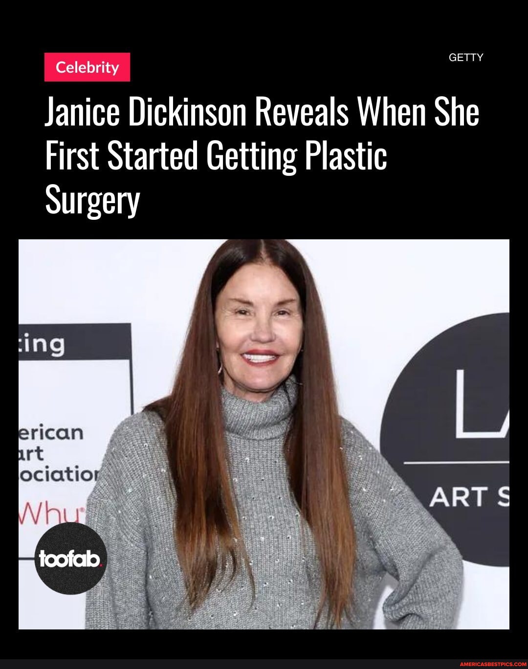 #JaniceDickinson recalls when she had her first "mini facelift" -- and ...