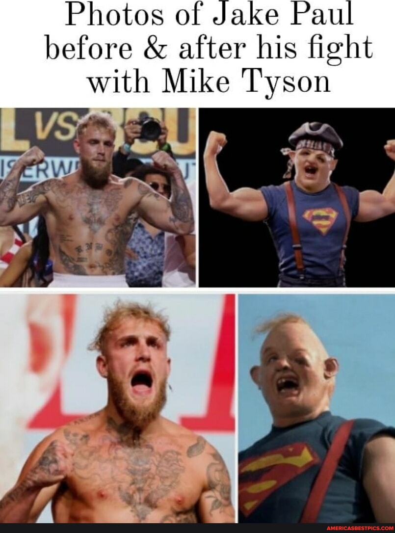 Photos of Jake Paul before & after his fight with Mike Tyson - America ...