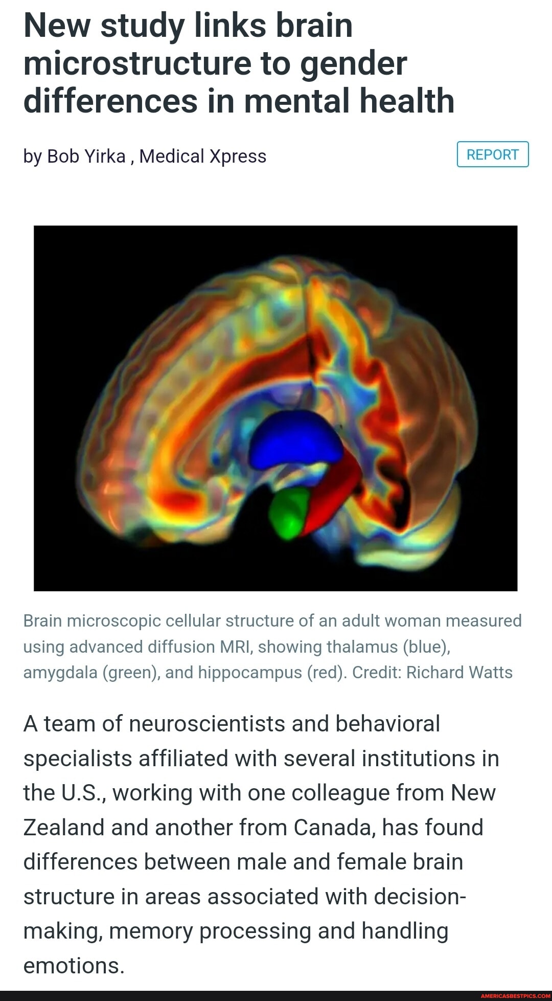 New study links brain microstructure to gender differences in mental ...