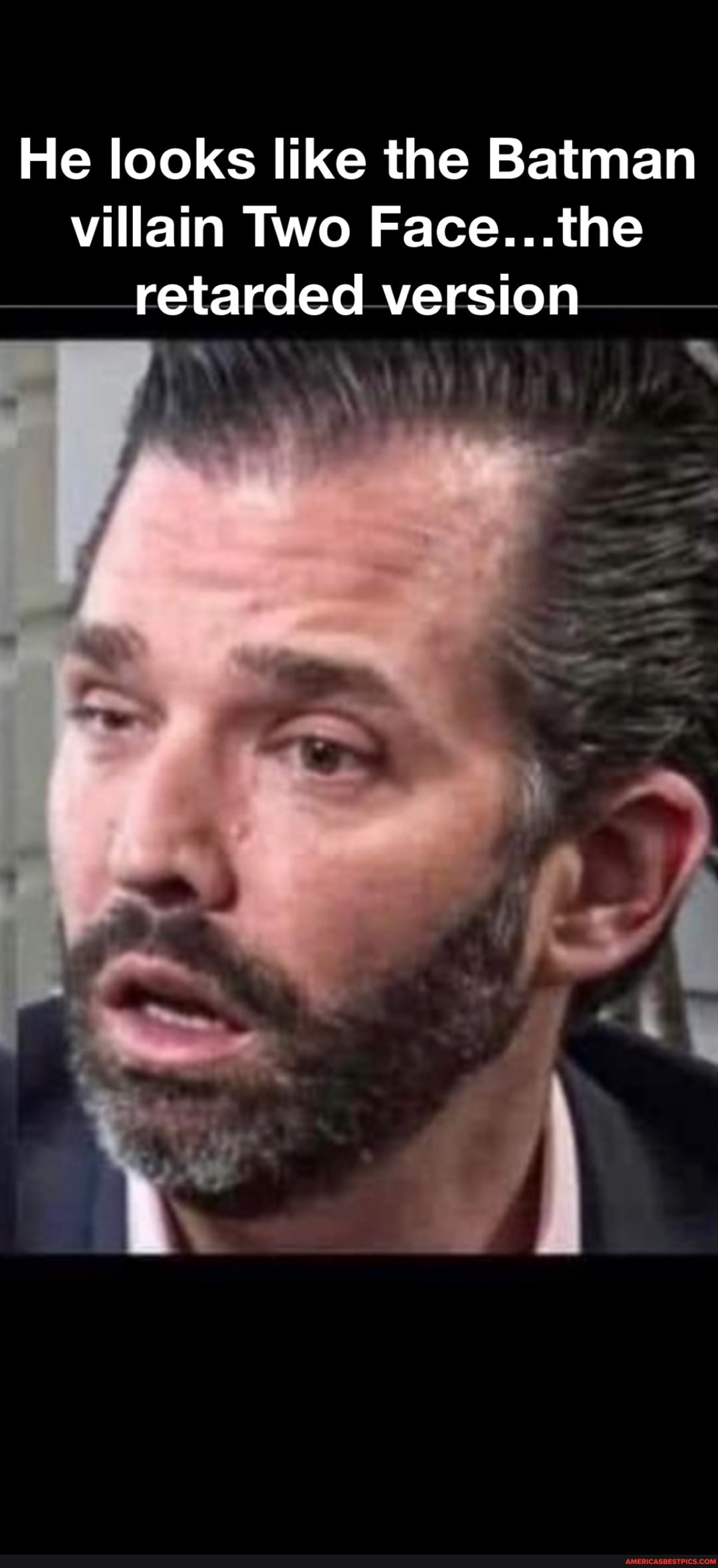 He looks like the Batman villain Two Face...the retarded version ...