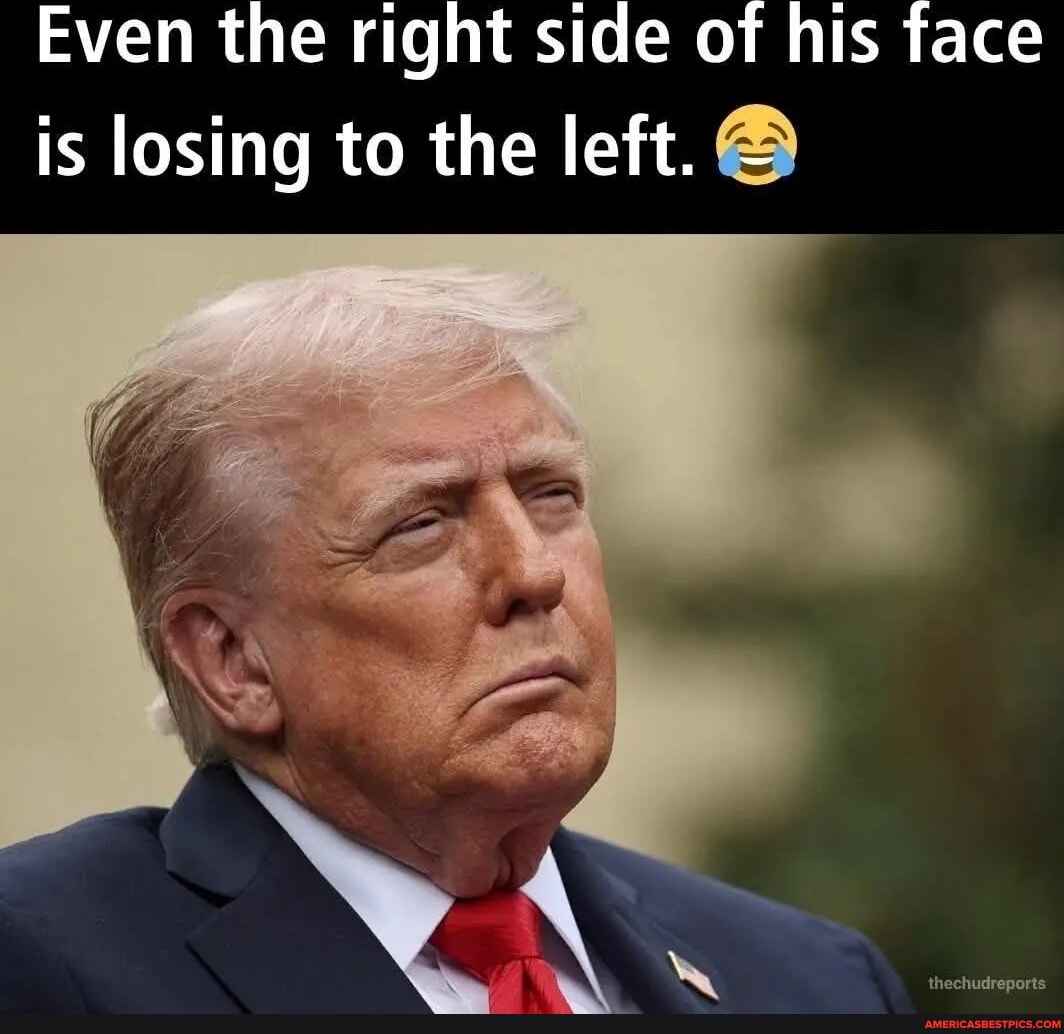 Even the right side of his face is losing to the left. - - America’s ...