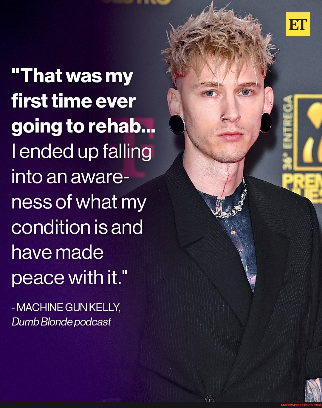 Machine Gun Kelly is opening up about his sobriety journey. While ...