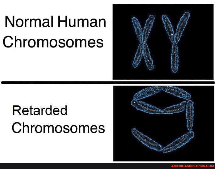 Normal Human Chromosomes Retarded Chromosomes - America’s best pics and ...
