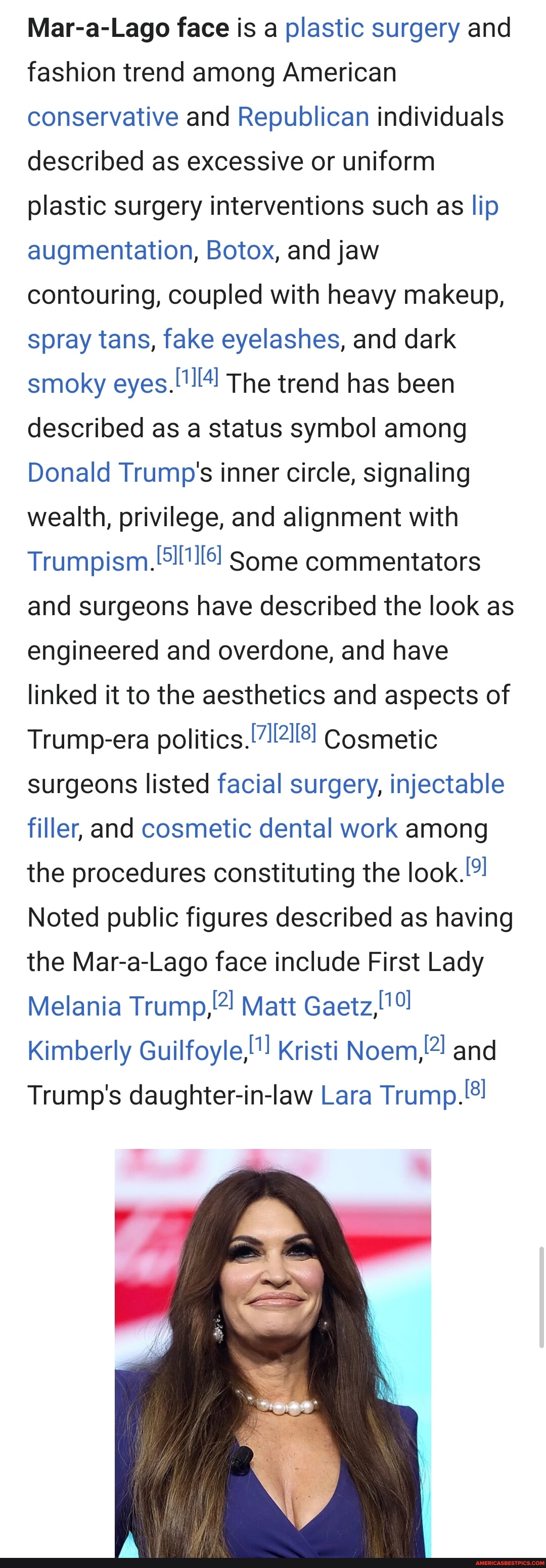 Mar-a-Lago face is a plastic surgery and fashion trend among American ...
