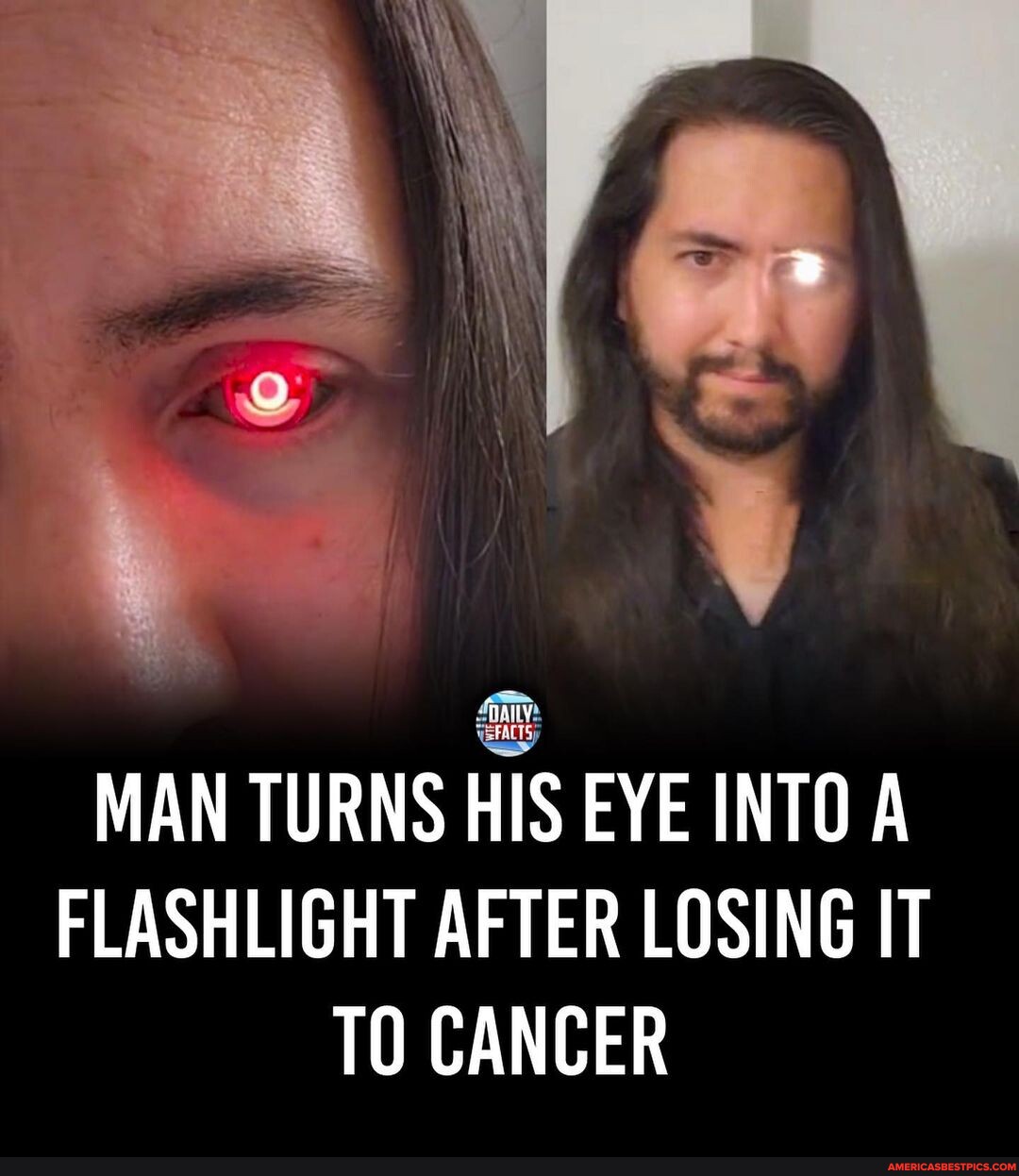 A 33-year-old man from the US has created an eye-catching innovation. Brian Stanley lost an eye ...