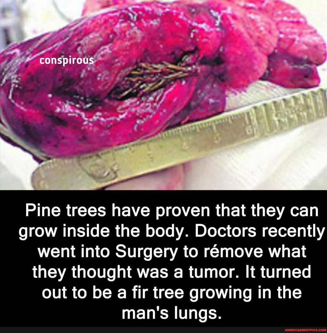 Conspirous Pine trees have proven that they can grow inside the body ...
